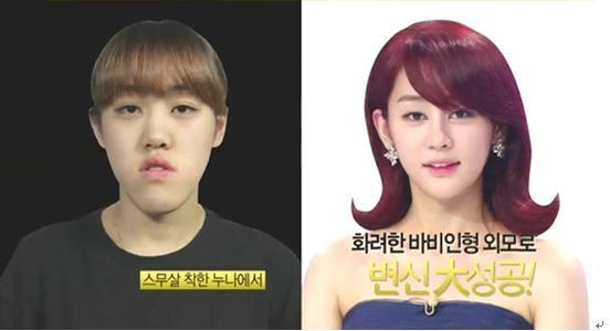 Reality TV hypes plastic surgery craze - The Korea Herald