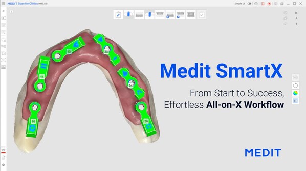 Revolutionizing All-on-X: Medit's Game-Changing Workflow Will Launch ...