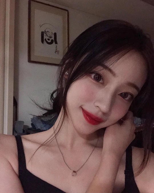 [POP이슈]"죽기 직전까지 갔는데" BJ 유화, 짭구 데이트 폭력 이후.."관계 정리, 법적처벌X" - 헤럴드 POP